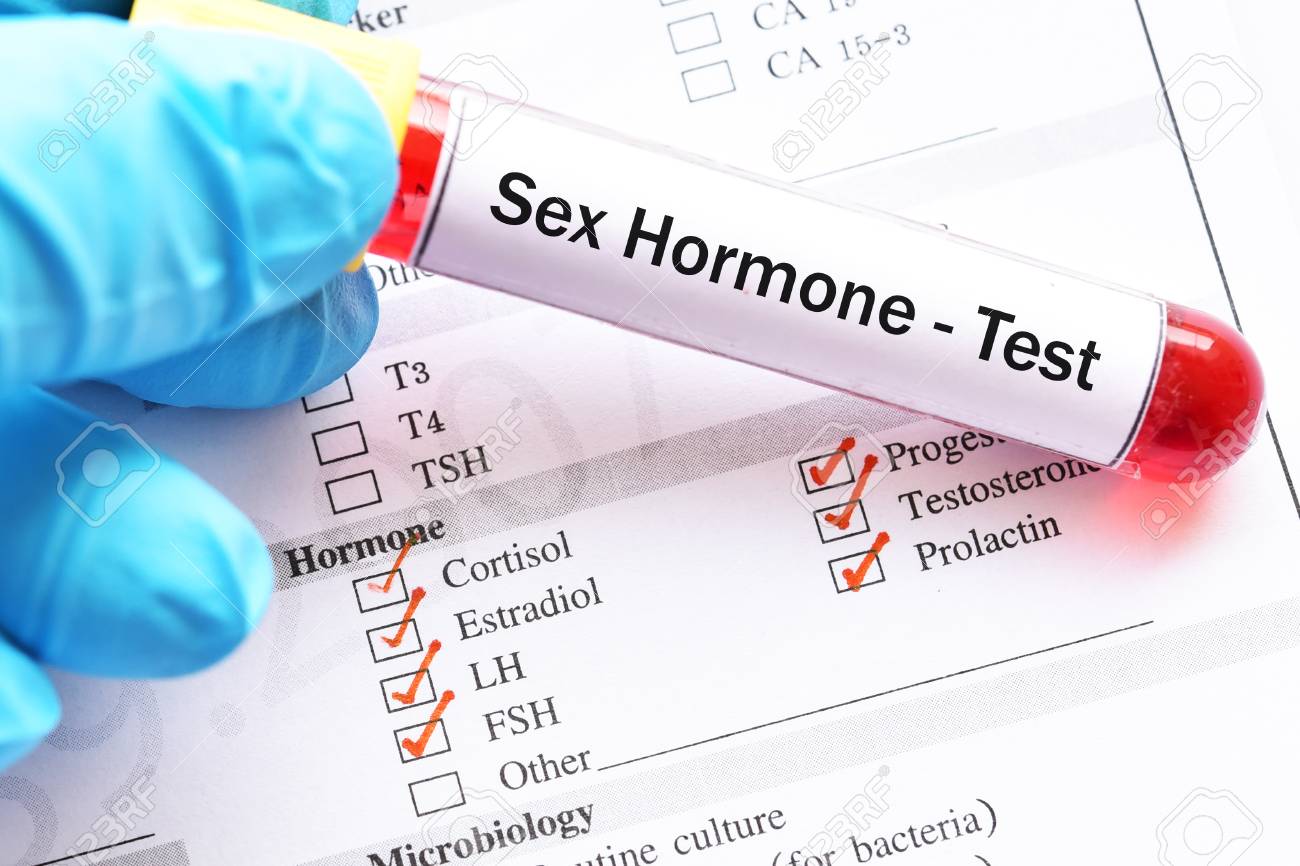 Hormone Testing